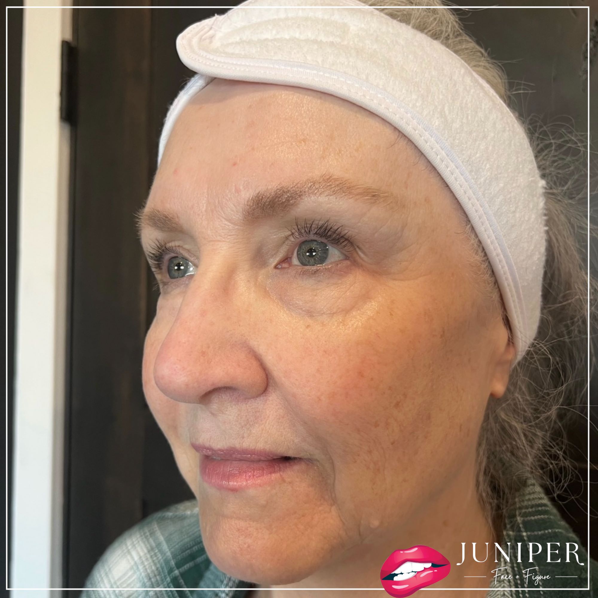 Emface | Juniper Face + Figure