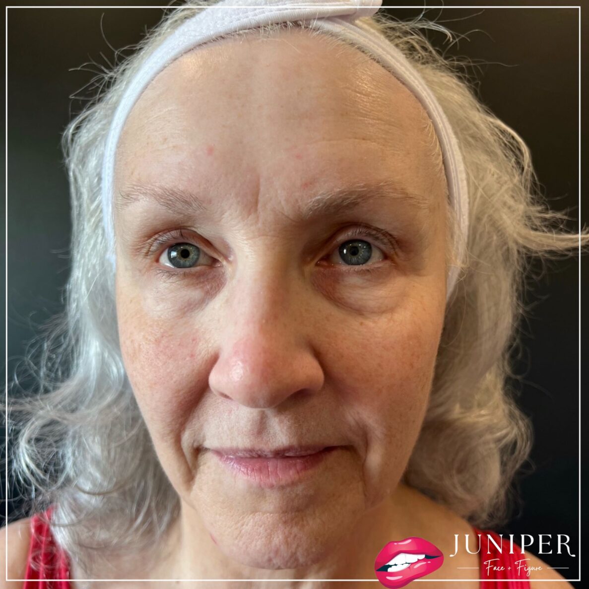 Emface | Juniper Face + Figure