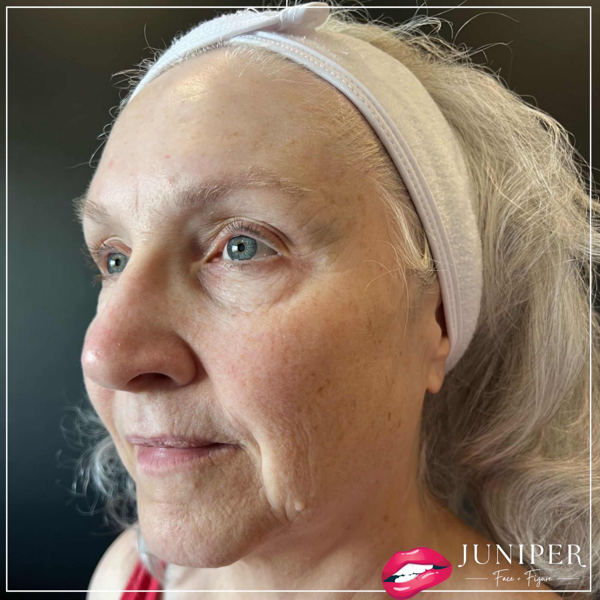 Emface | Juniper Face + Figure