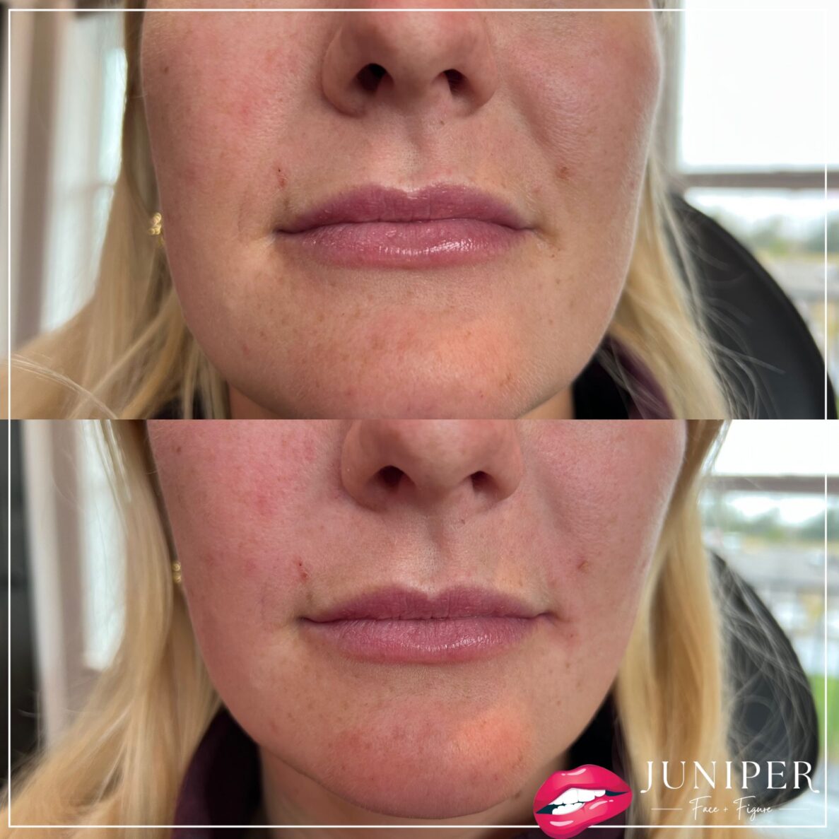 Pyriform Fossa, #4 - Juniper Face + Figure