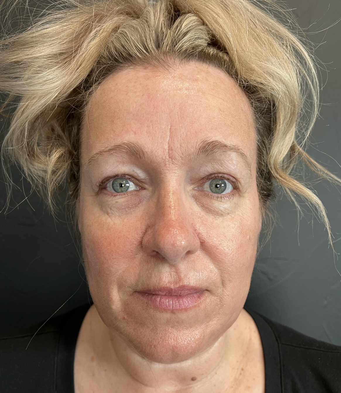 Emface | Juniper Face + Figure