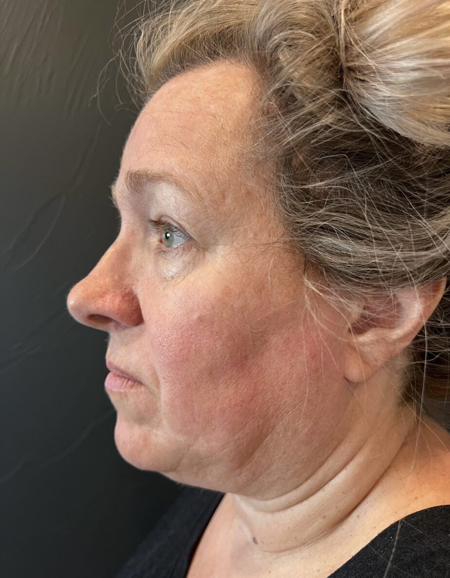 Emface | Juniper Face + Figure