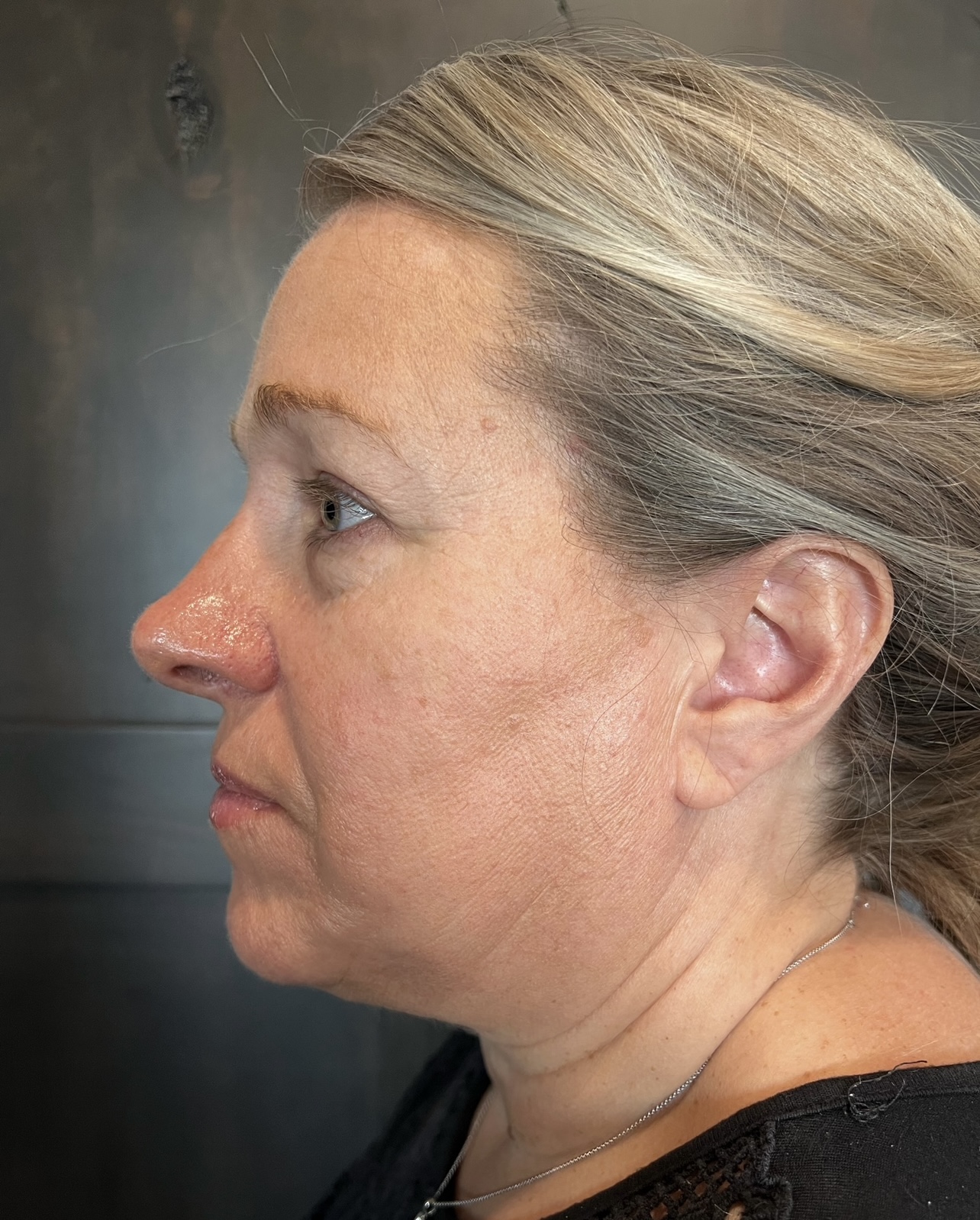 Emface | Juniper Face + Figure