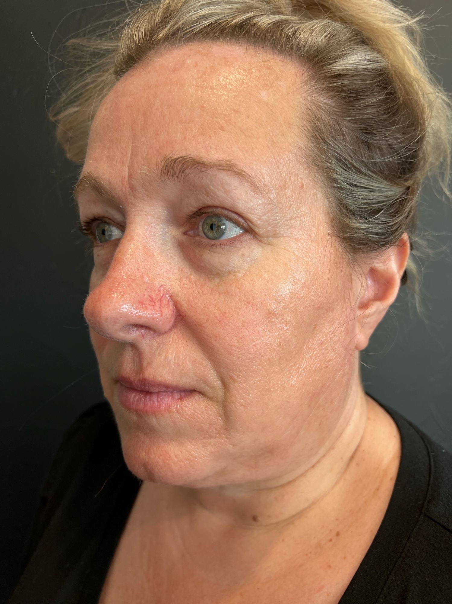 Emface | Juniper Face + Figure