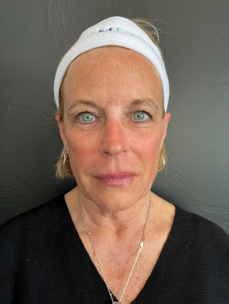 Emface | Juniper Face + Figure