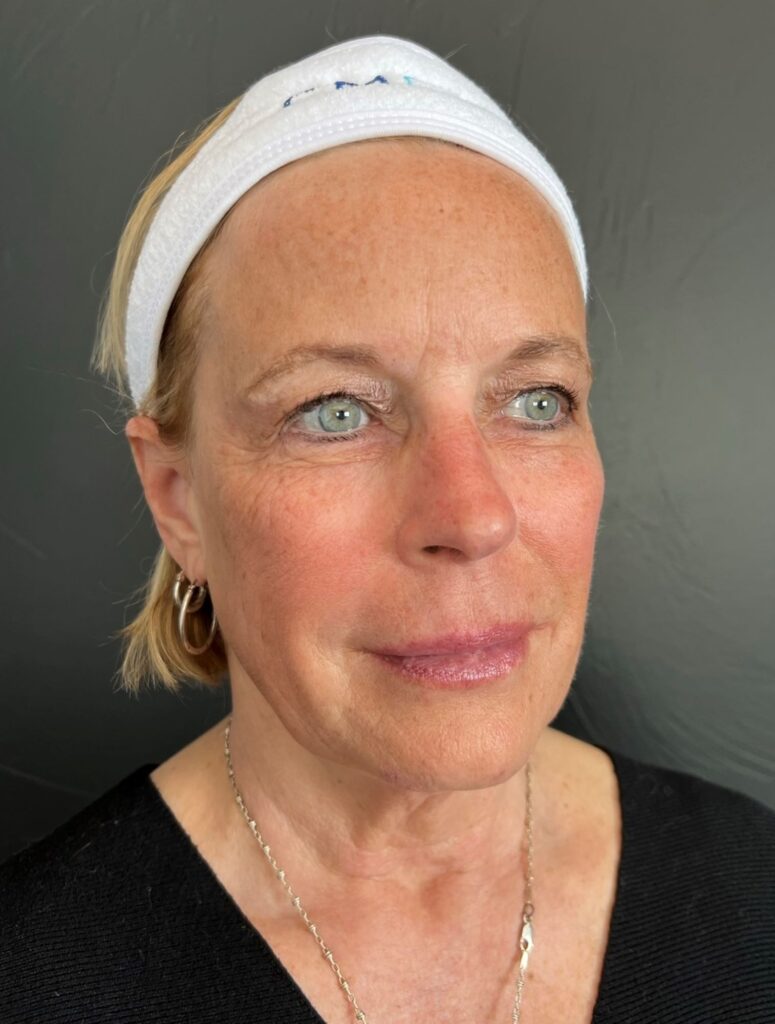 Emface | Juniper Face + Figure