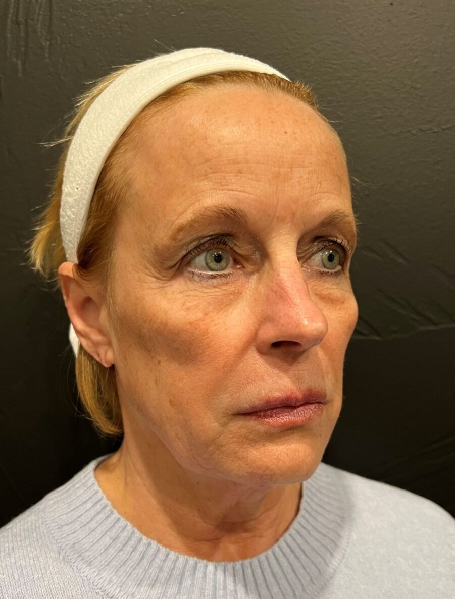 Emface | Juniper Face + Figure