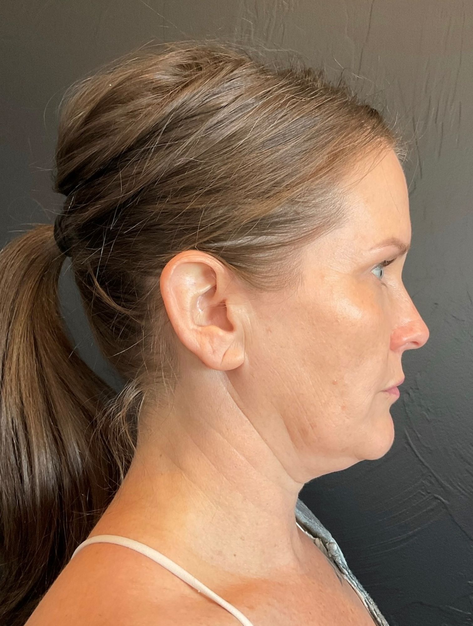 Emface | Juniper Face + Figure