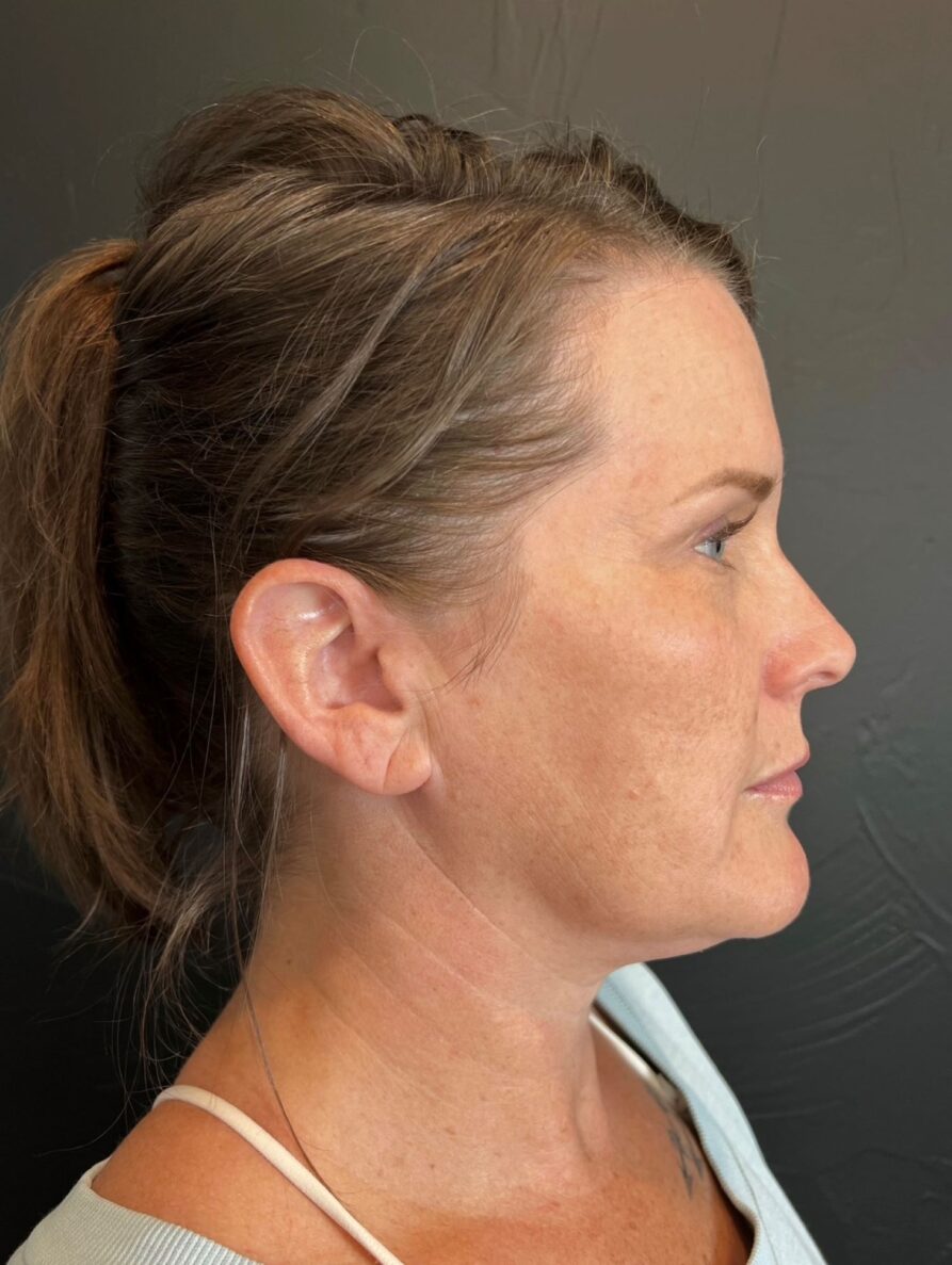 Emface | Juniper Face + Figure