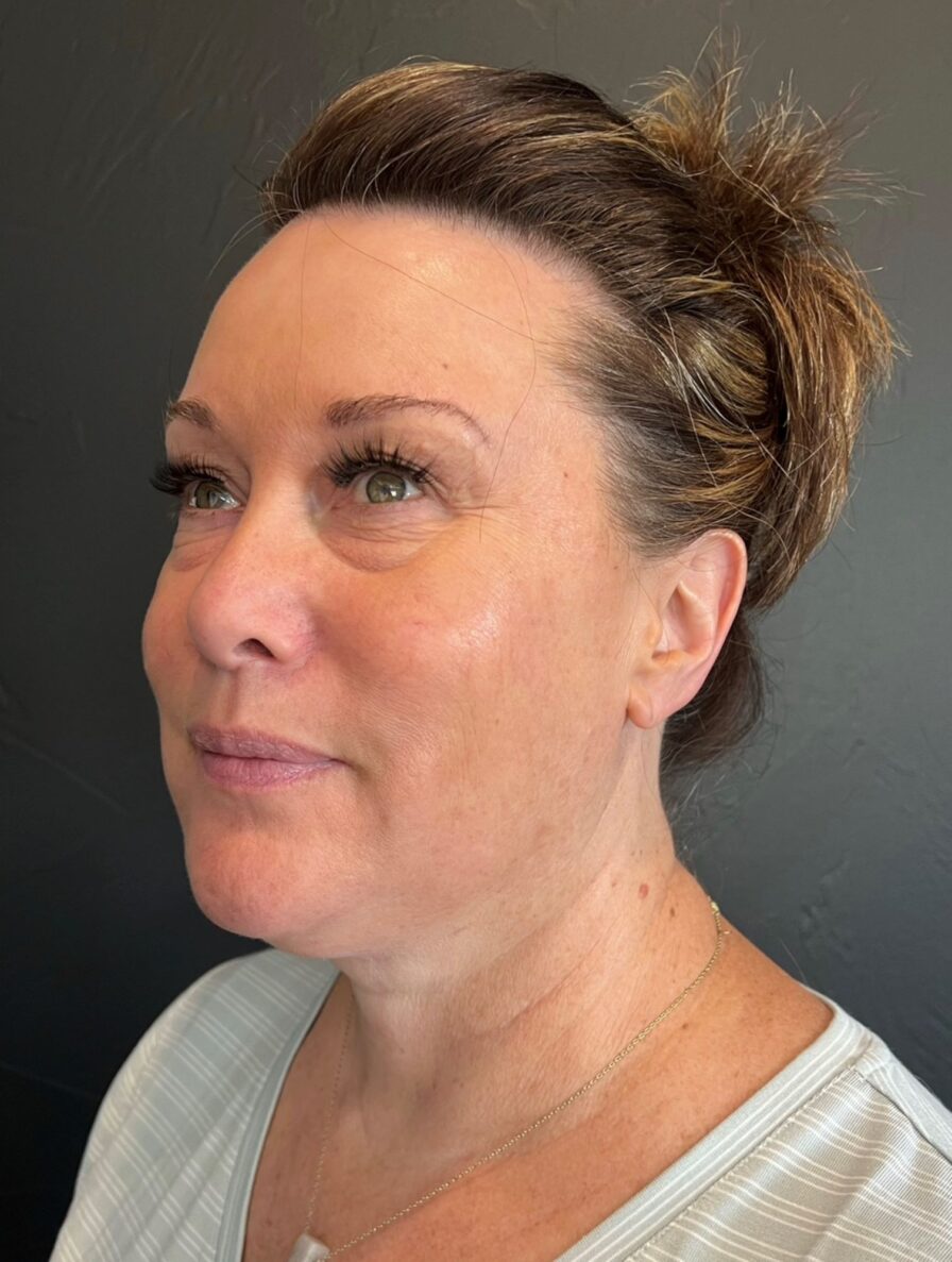 Emface | Juniper Face + Figure