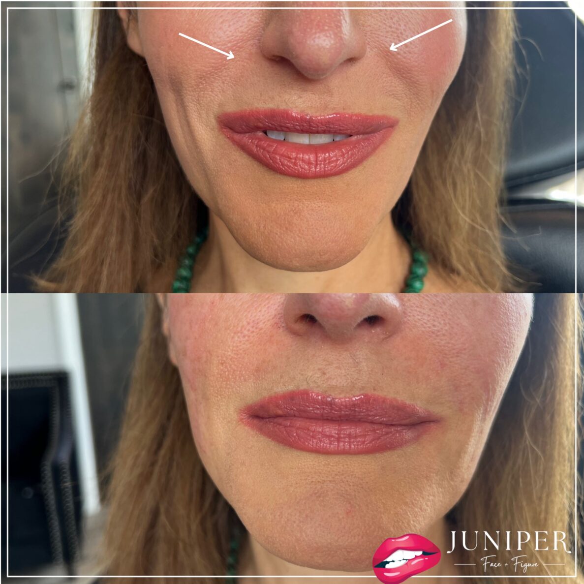 Pyriform Fossa, #3 - Juniper Face + Figure