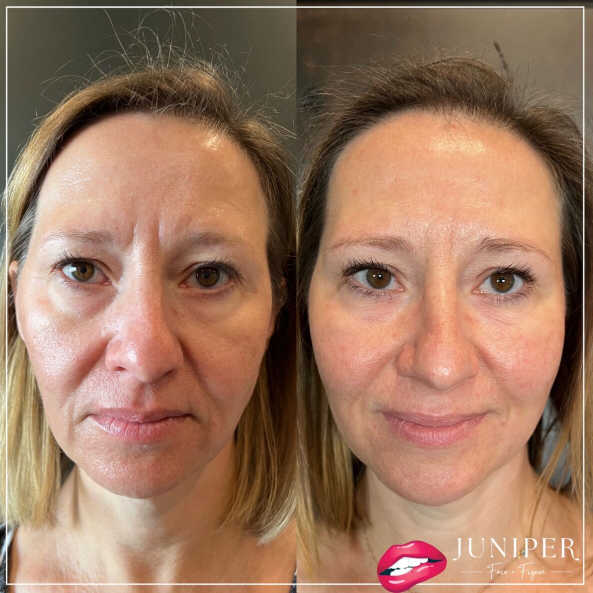 EMFACE #14 - Juniper Face + Figure